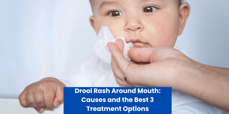 Drool Rash Around Mouth: Causes and the Best 3 Treatment Options - Baba Me